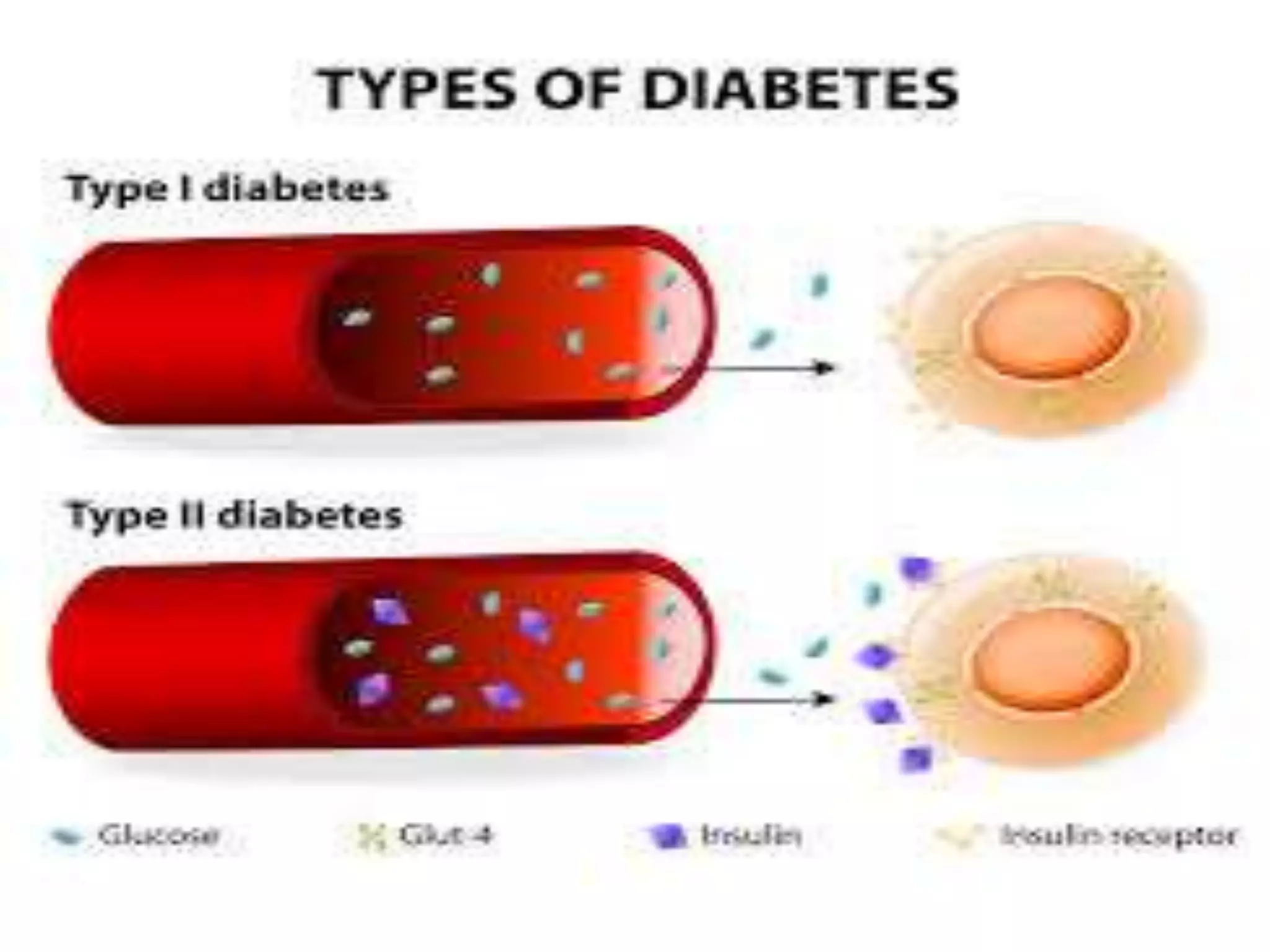 Diabetes | PPT