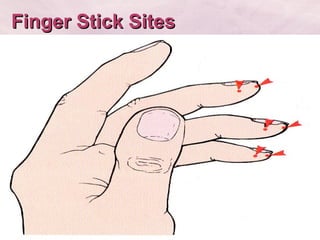 Diabetes mellitus & blood glucose monitoring | PPT