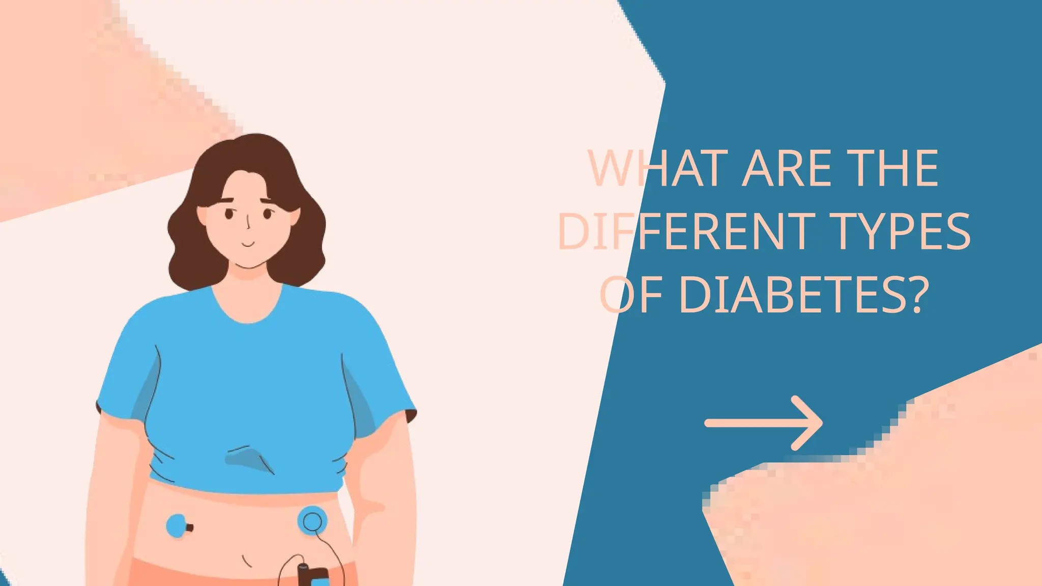 Introduction to Diabetes (Type I, II, Gestational) | PPTX