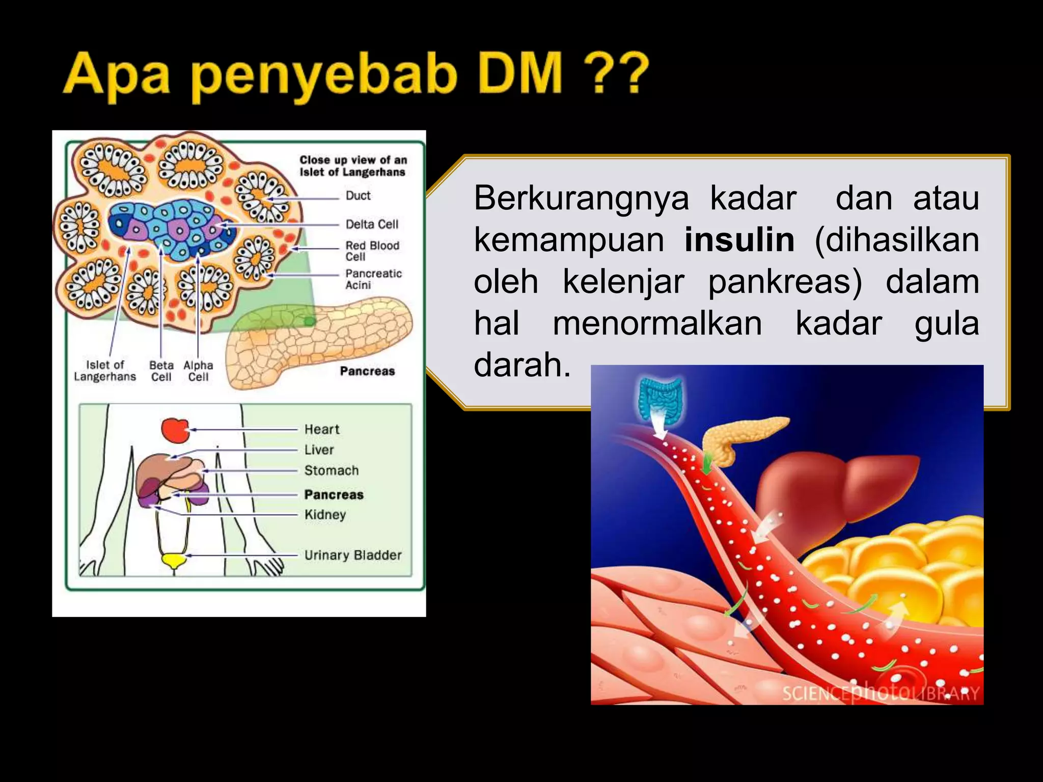 DIABETES-MELLITUS.ppt