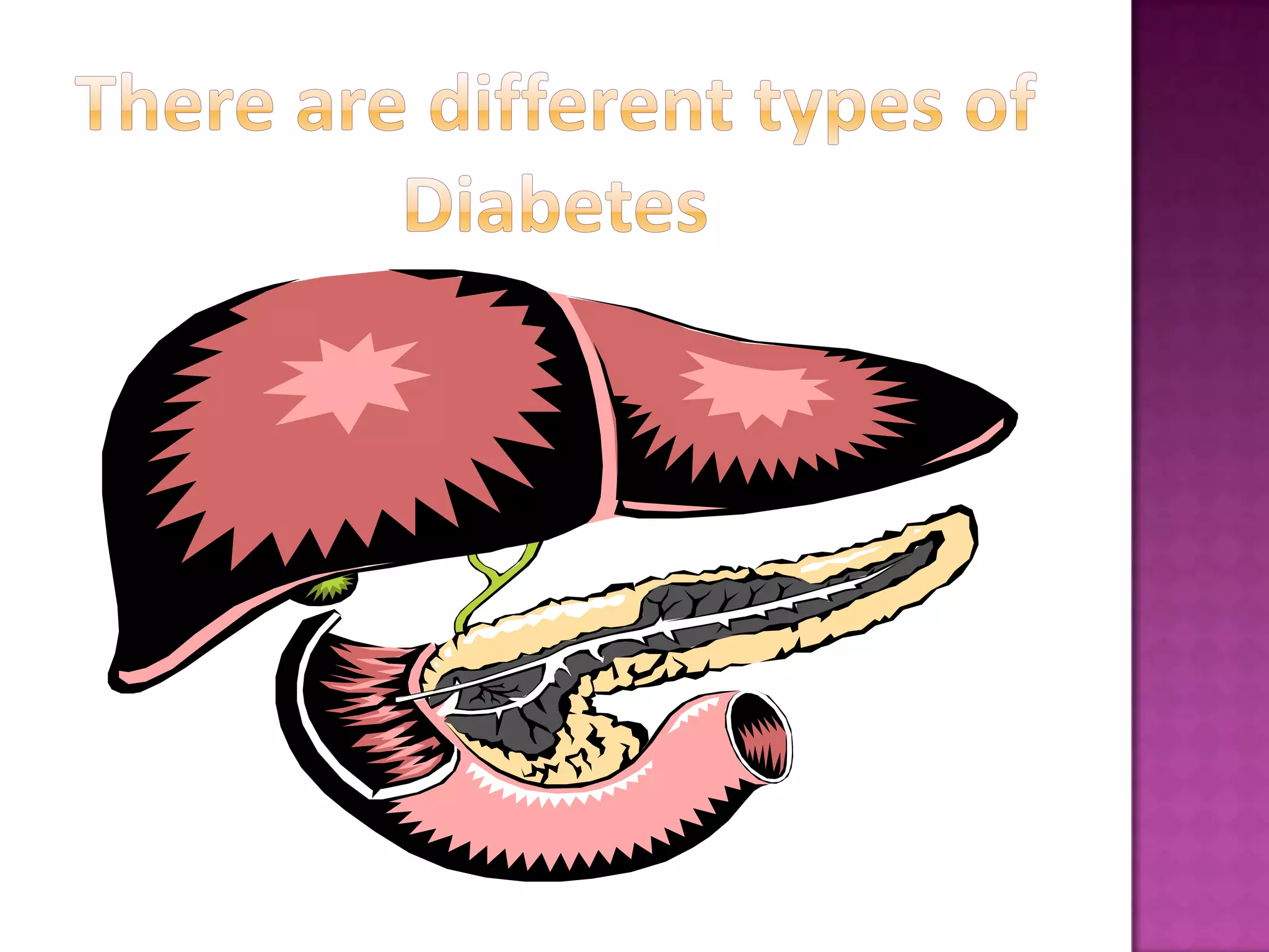 Diabetes Powerpoint 6 | PPTX