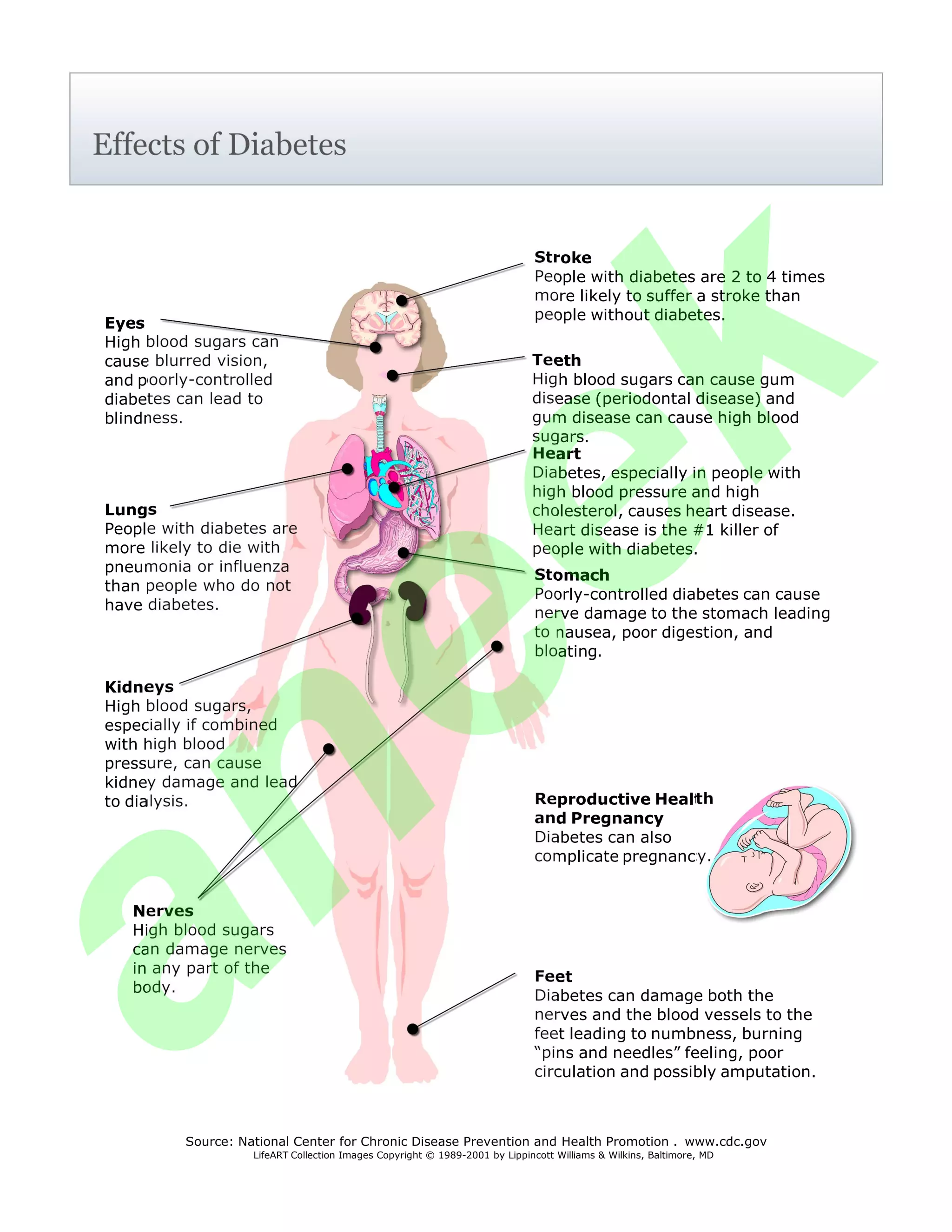 Diabetes A Synopsis By Aneek Gupta | PDF | Diabetes | Diseases and ...