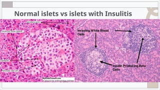 Pathogenesis of Diabetes Mellitus: Understanding the Mechanisms Behind ...