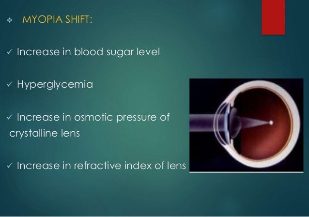DIABETES AND THE EYE