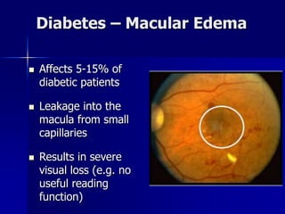 diabetes (2).ppt