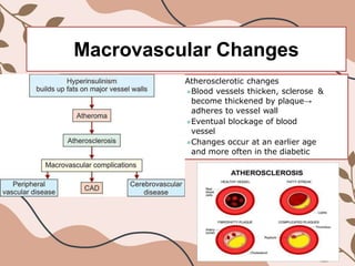 DIABETES AND CARDIOVASCULAR DISEASE- AKMAL.pptx