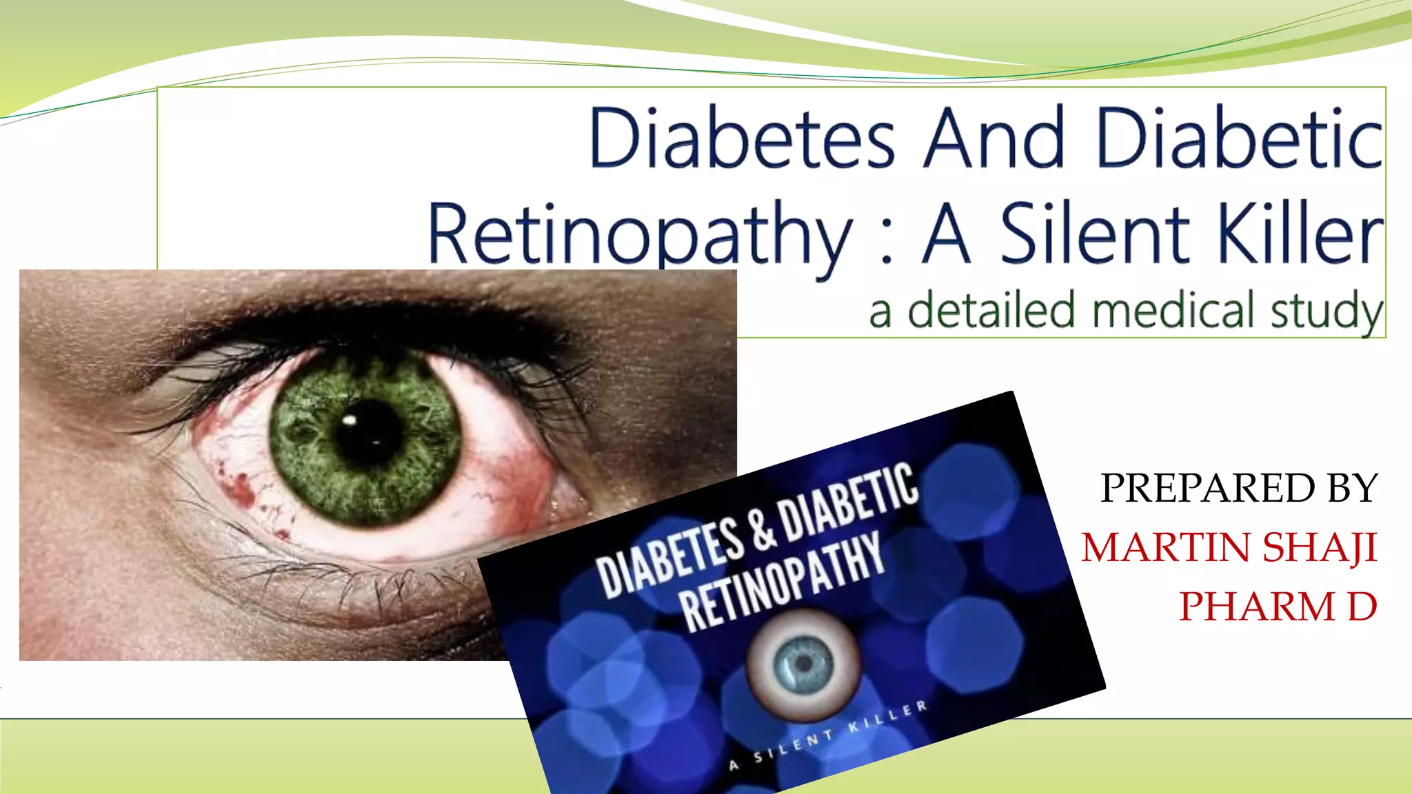 Diabetes and diabetic retinopathy: A Silent Killer-a detailed medical ...