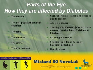 Diabetesand Eye Care | PPT