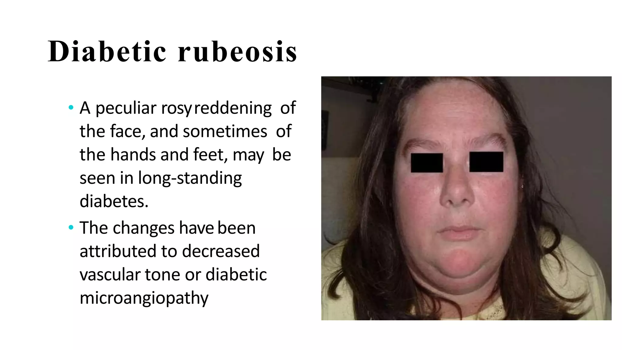 Diabetes and skin.pdf