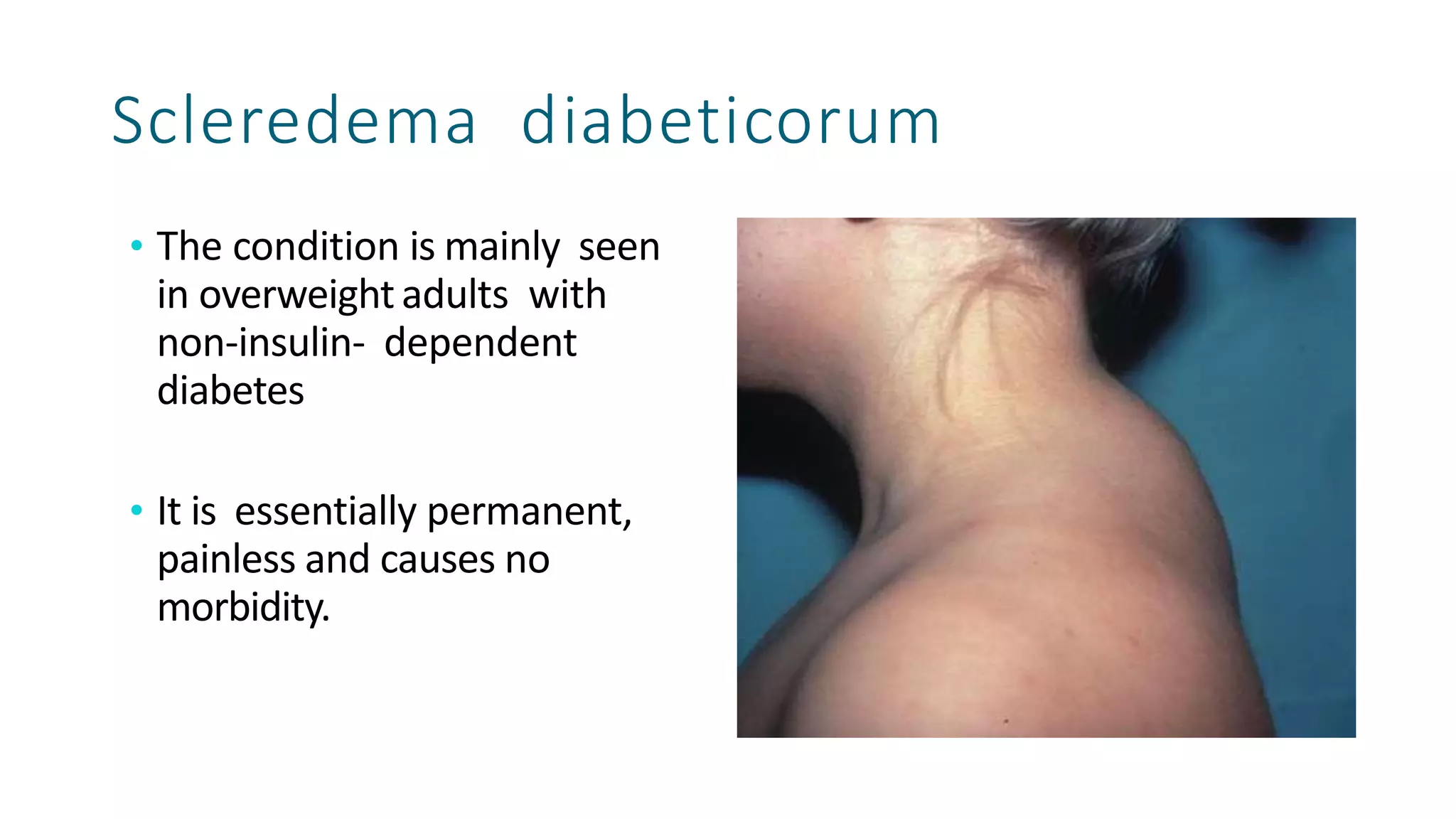 Diabetes and skin.pdf