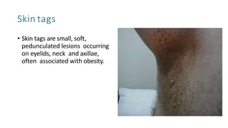Diabetes and skin.pdf