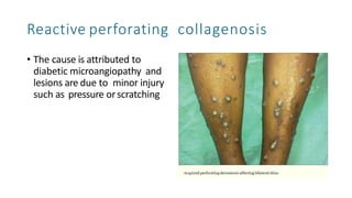 Diabetes and skin.pdf