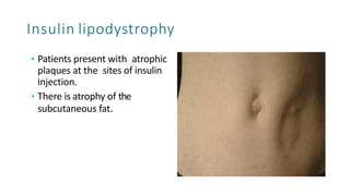 Diabetes and skin.pdf