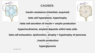 Diabetes Mellitus Type 2 | PPTX