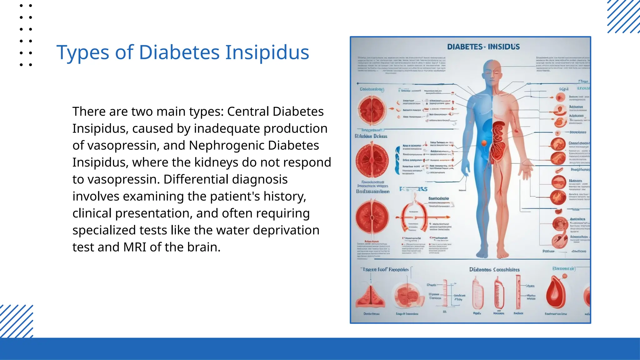 Diabetes Insipidus vs. Psychogenic Polydipsia.pptx