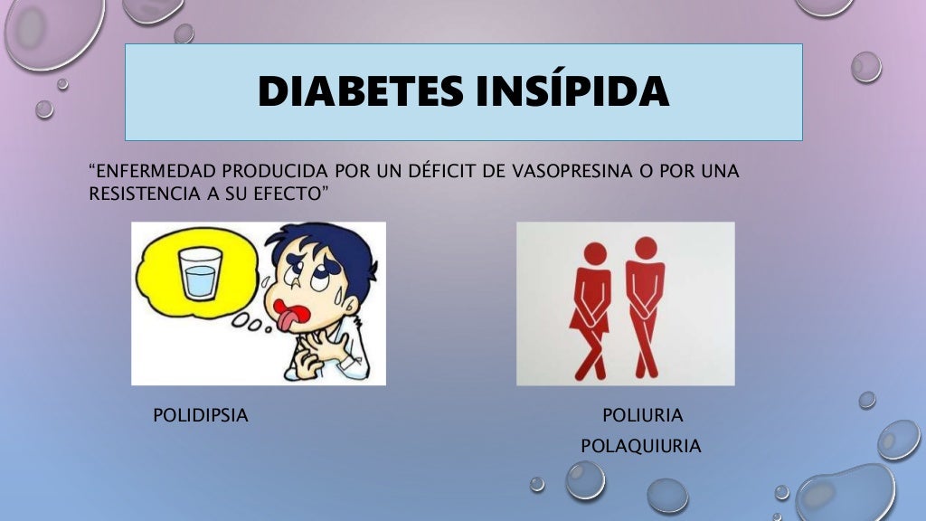 Diabetes insípida