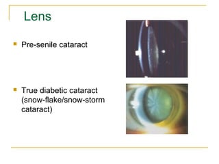 Diabetes melitis & eye part 1 presentation at www.eyenirvaan.com