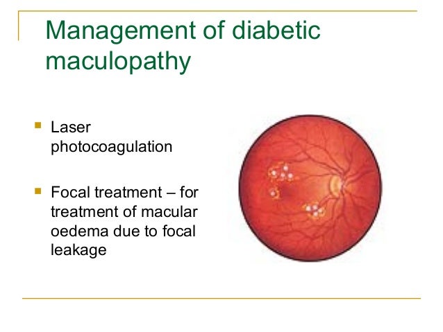 Diabetes melitis & eye part 1 presentation at www.eyenirvaan.com