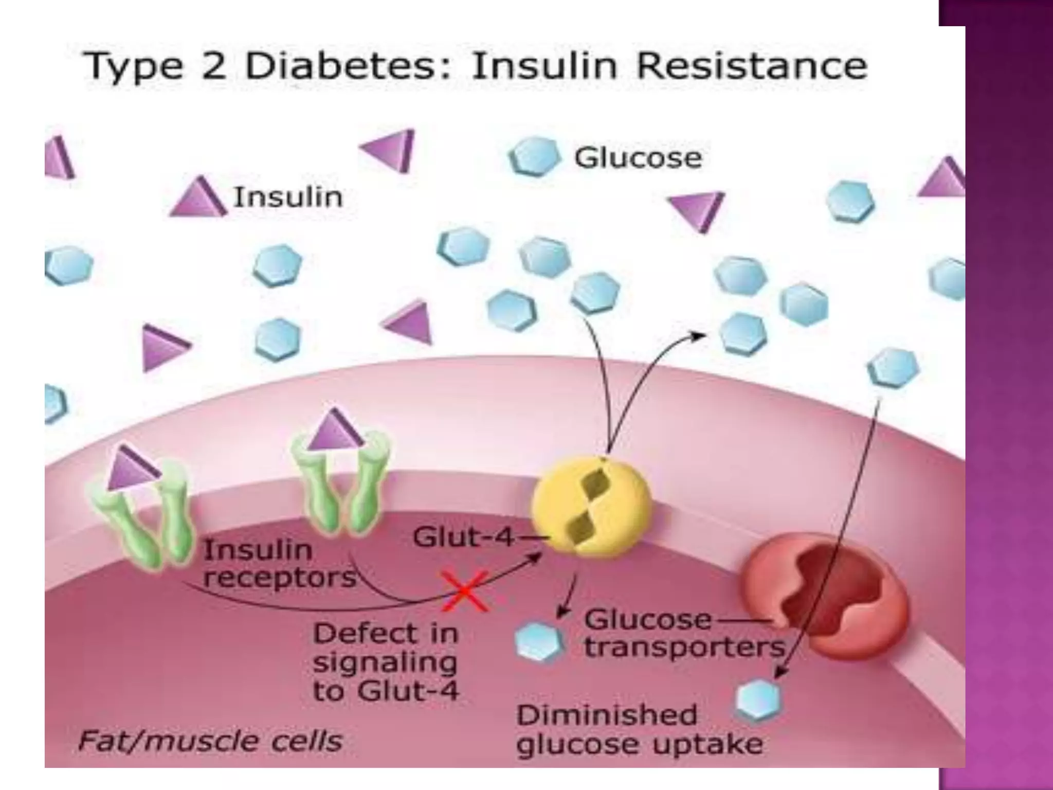 Diabetes mellitus | PPTX