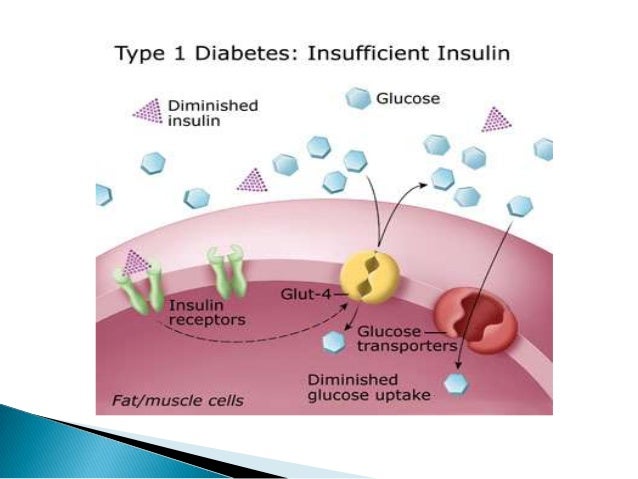 Diabetes mellitus Type 1