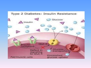 Diabetes mellitus (Definition, Classification, Clinical features) | PPTX