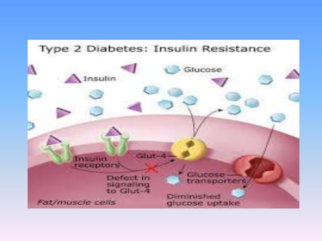 Diabetes mellitus (Definition, Classification, Clinical features ...