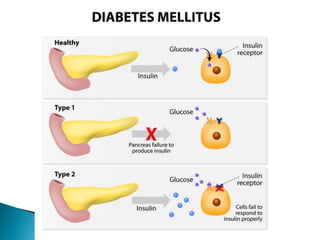 Diabetes mellitus- Easy explanation for Nurses | PDF