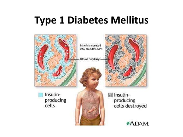 Diabetes mellitus - Pharmacology | PDF | Diabetes | Diseases and Conditions