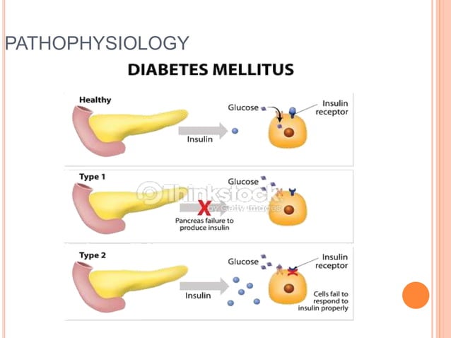 Diabetes Mellitus | PPT