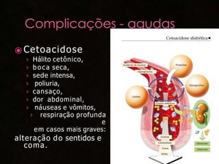 Aula sobre DIABETES MELLITUS complicações e tratamento pptx | PPT