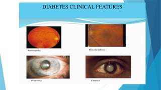 DIABETES MELLITUS CLINICAL FEATURES, CLASSIFICATION , SCREENING ...