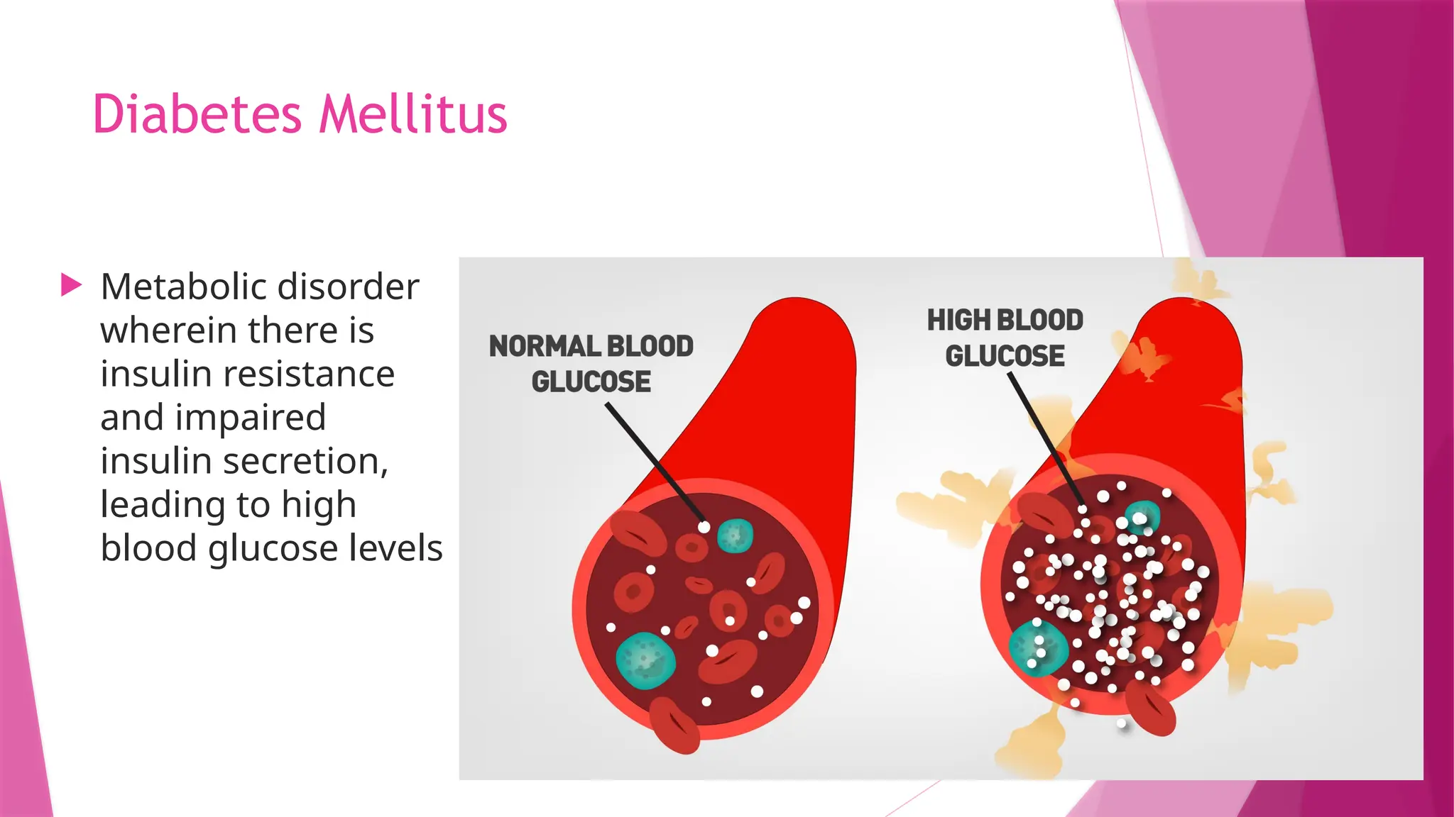 Diabetes Mellitus Lecture in the PHilippines | PPT