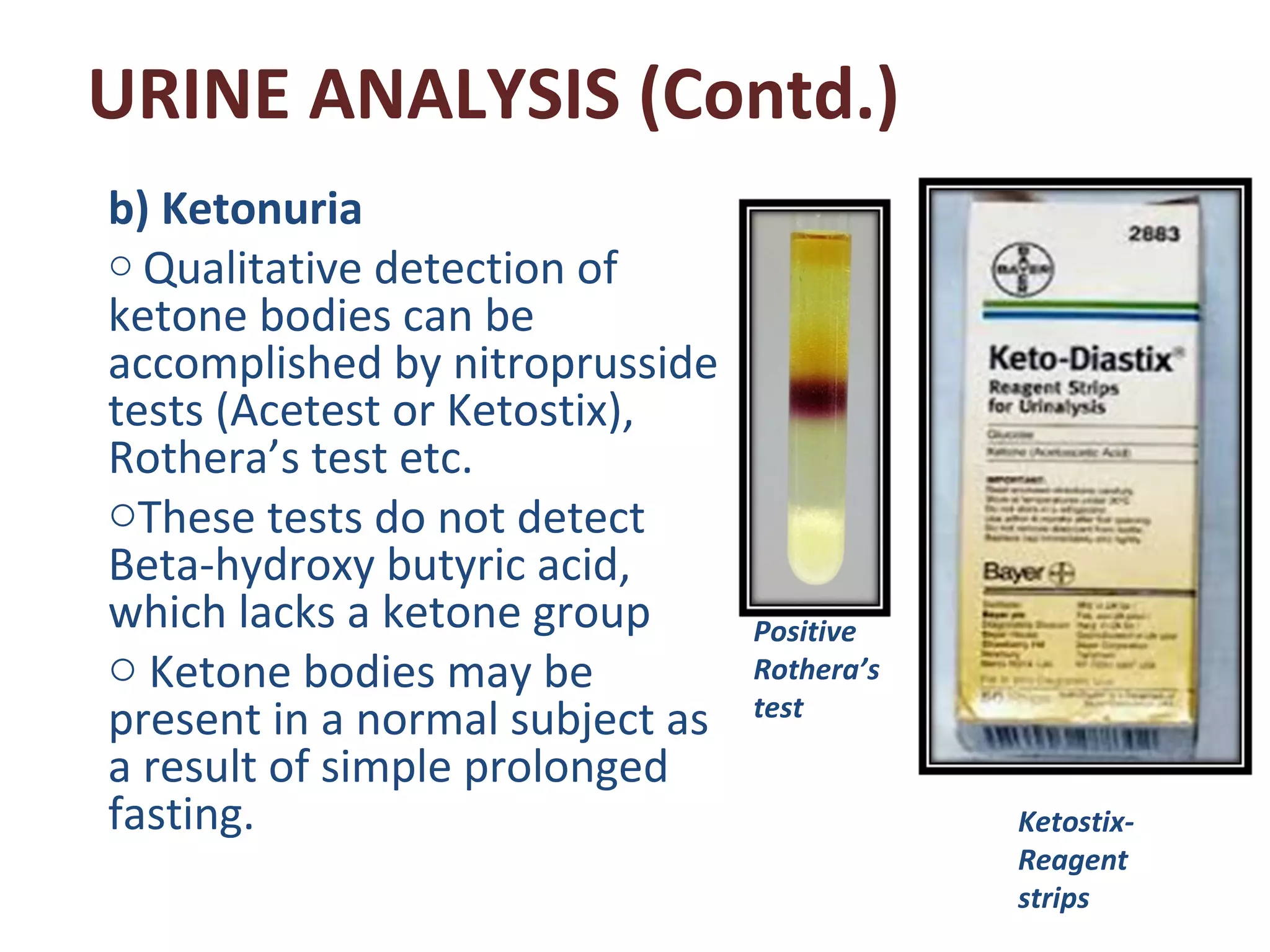 Diabetes mellitus - (Part-3) -- Laboratory diagnosis and management | PPT