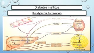 Diabetes mellitus 1 | PPTX