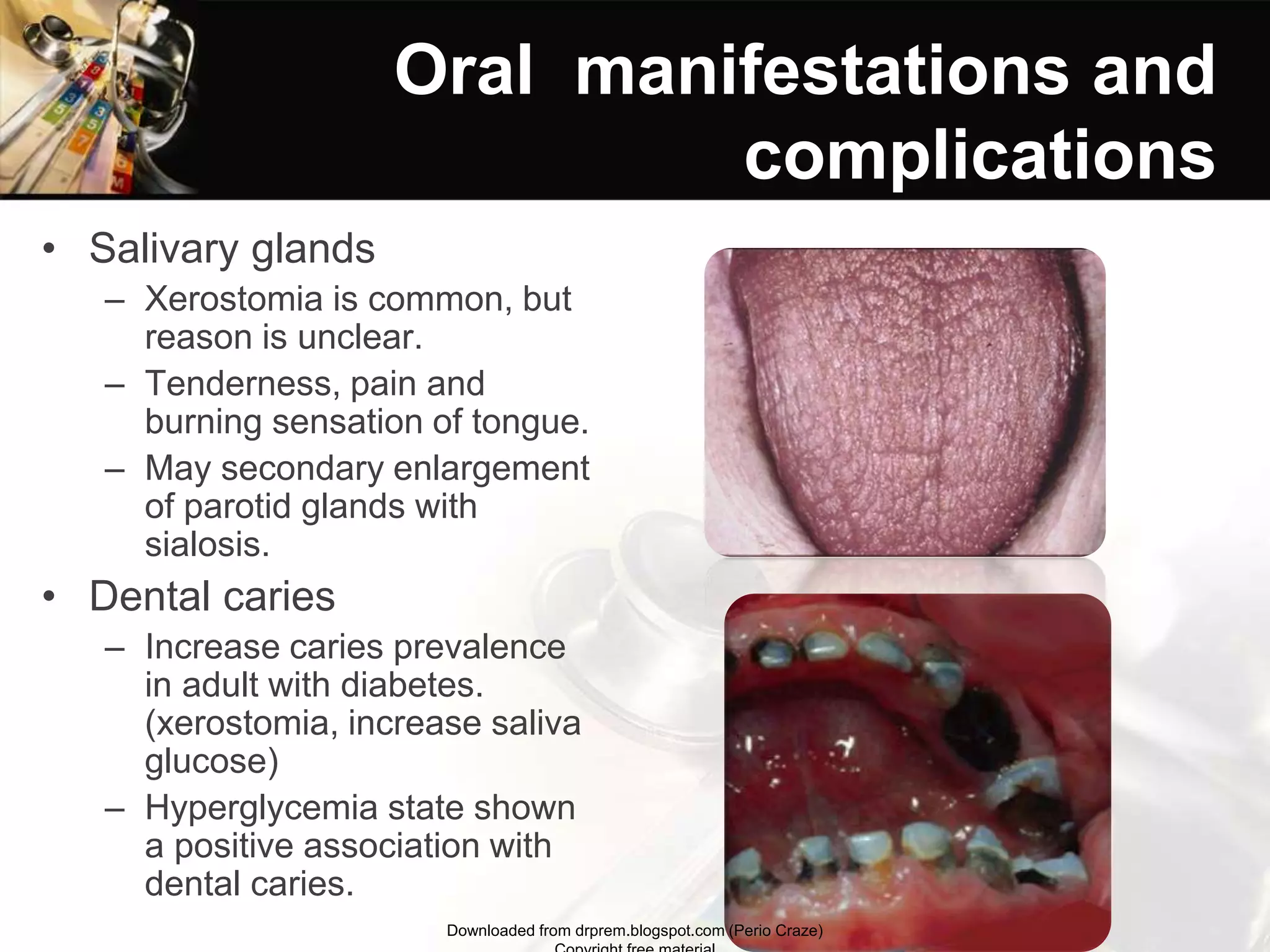 Diabetes_Mellitus_and_Periodontitis.ppt