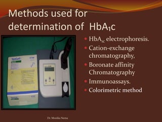 Laboratory diagnosis of Diabetes mellitus | PPTX