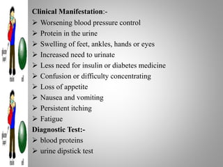 Diabetes mellitus | PPTX