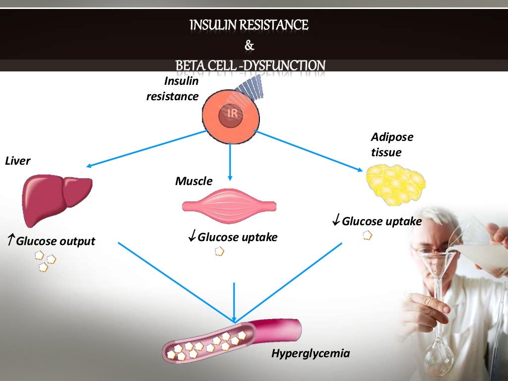 Diabetes mellitus type 2(biochemistry)