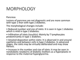 Diabetes Mellitus Type 2 - Pathology.pptx