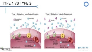 Diabetes Mellitus & Wedica | PPTX