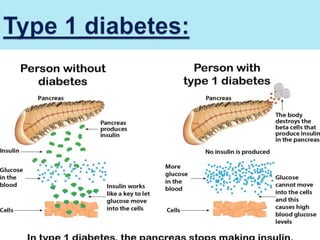 Diabetes mellitus Type 1 and Type 2 | PPTX