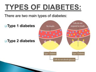 Diabetes mellitus Type 1 and Type 2 | PPTX