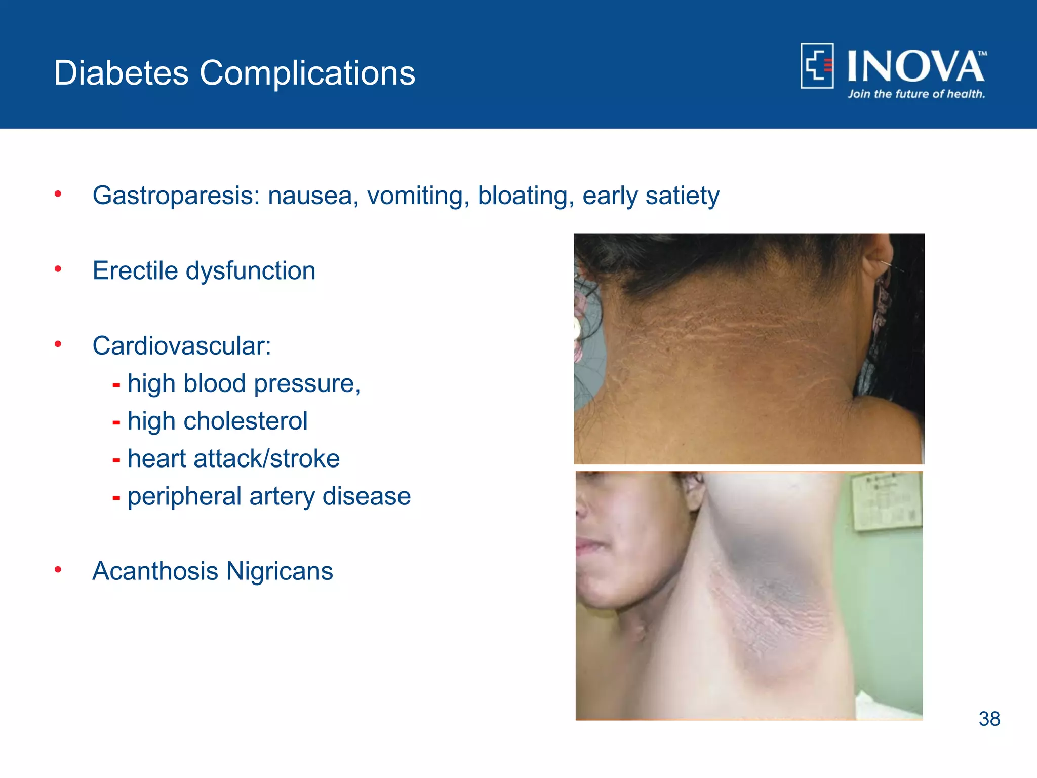 Symptoms of Pre-Diabetes and Diabetes Prevention Tips | PPT