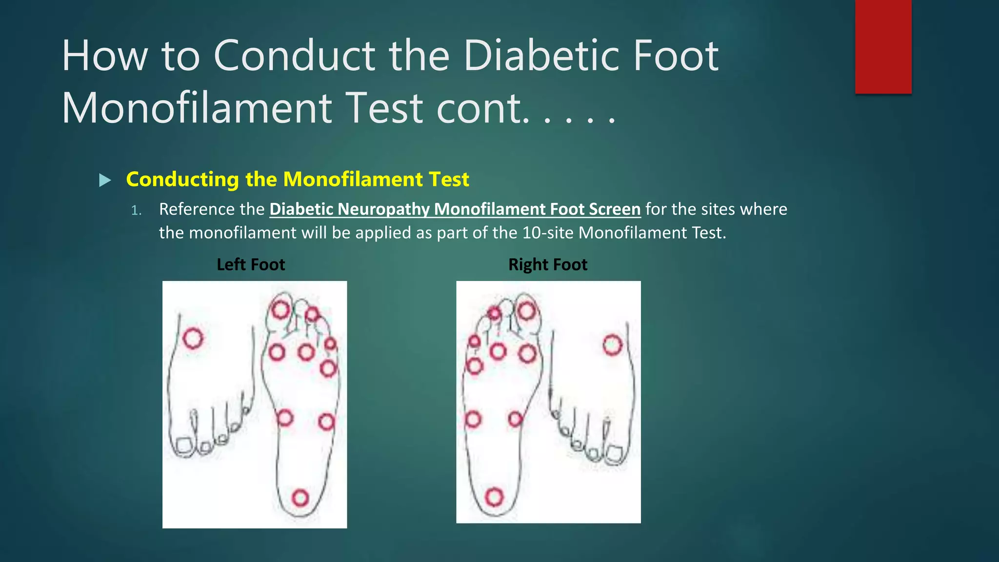 Diabetes, Peripheral Neuropathy & How to Conduct | PPTX | Foot Health ...