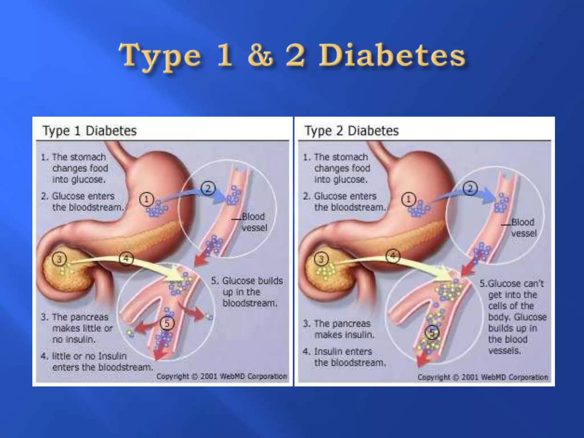 Diabetes powerpoint | PPTX | Diabetes | Diseases and Conditions