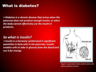 Diabetes presentation 1 complete one | PPTX