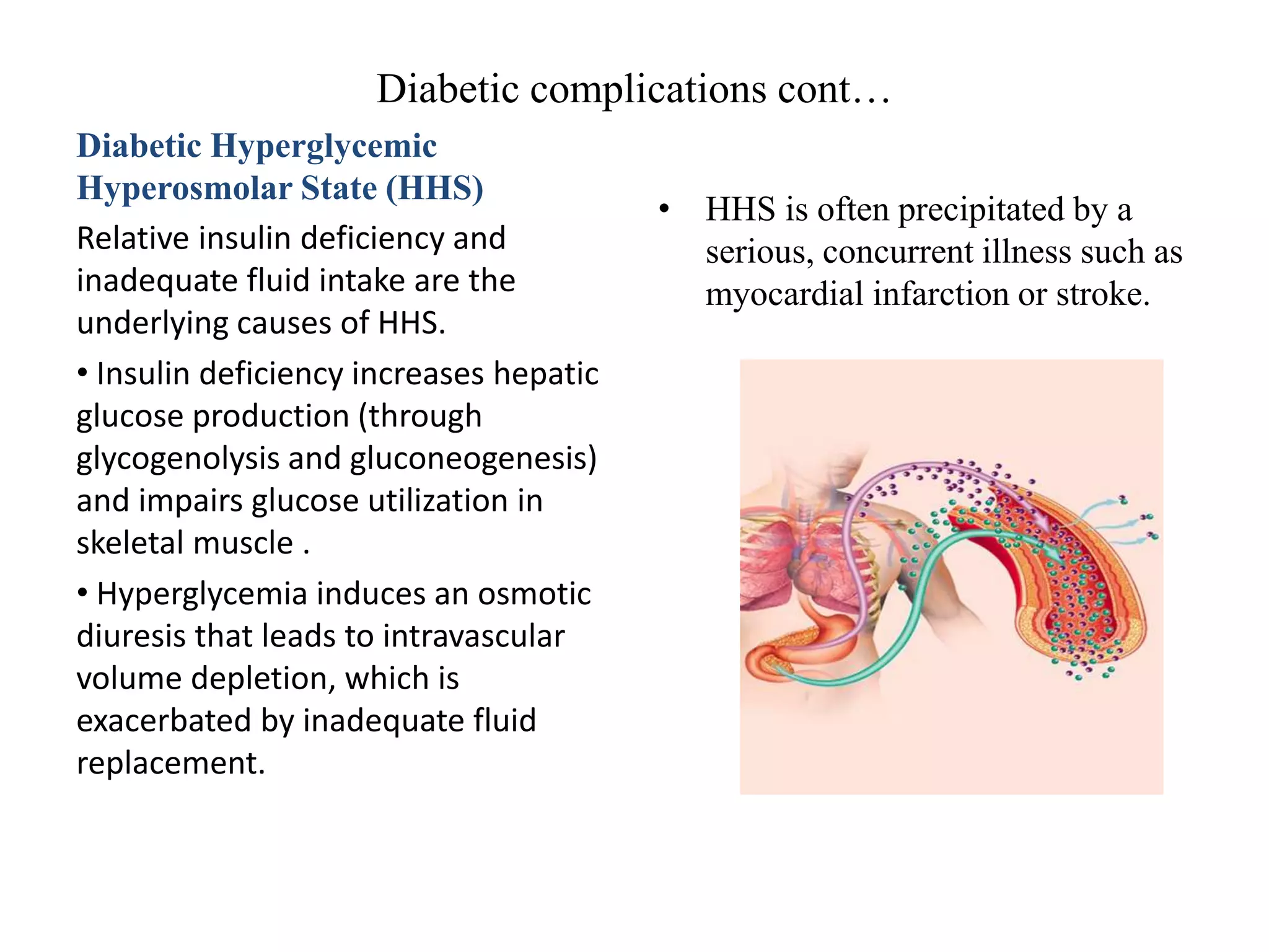 COMPLICATIONS, MANAGEMENT AND TREATMENT APPROACH OF DIABETES MELLITUS ...