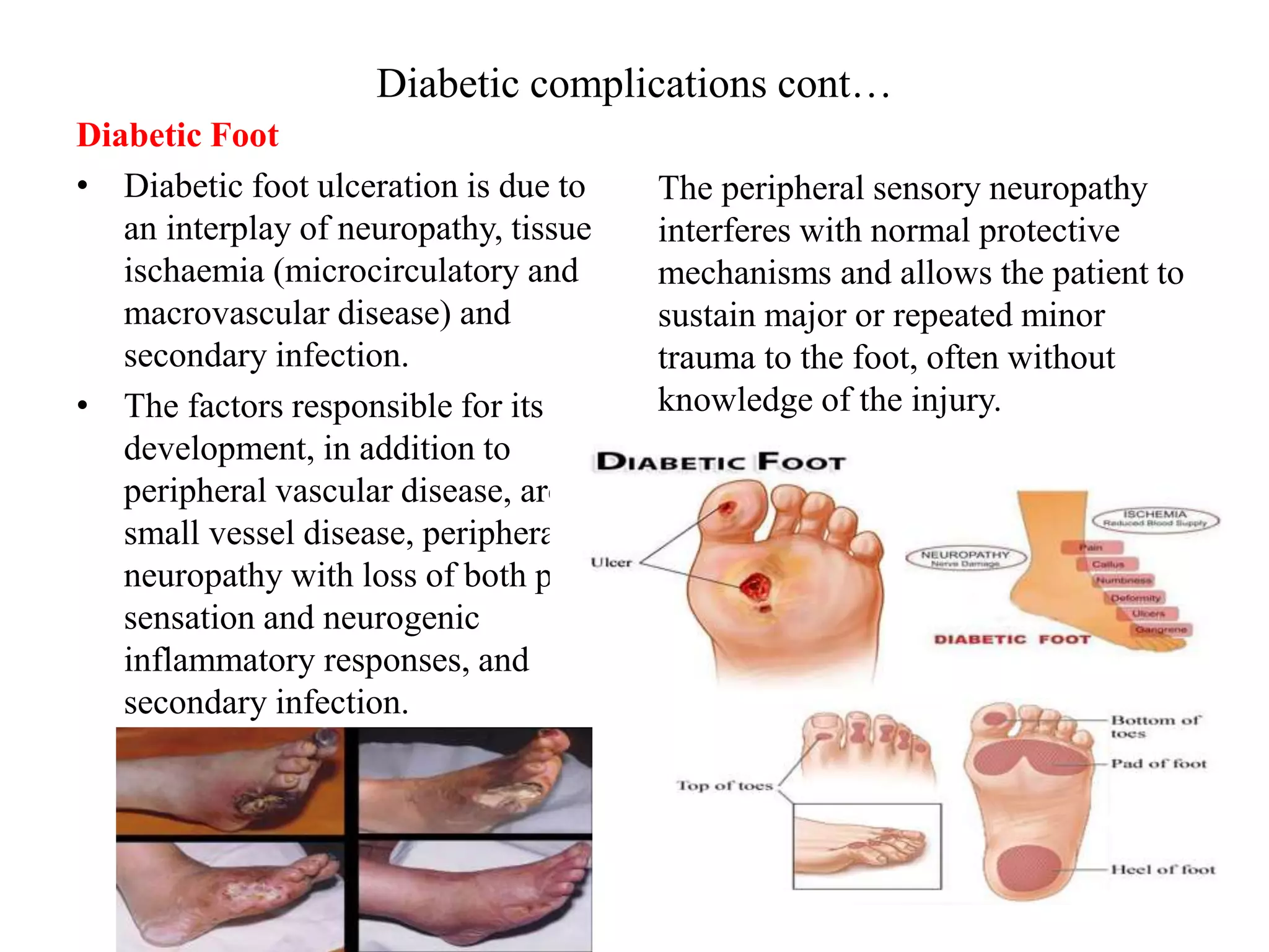 COMPLICATIONS, MANAGEMENT AND TREATMENT APPROACH OF DIABETES MELLITUS ...