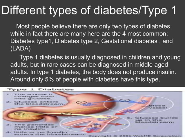 Diabetes project done | PPT