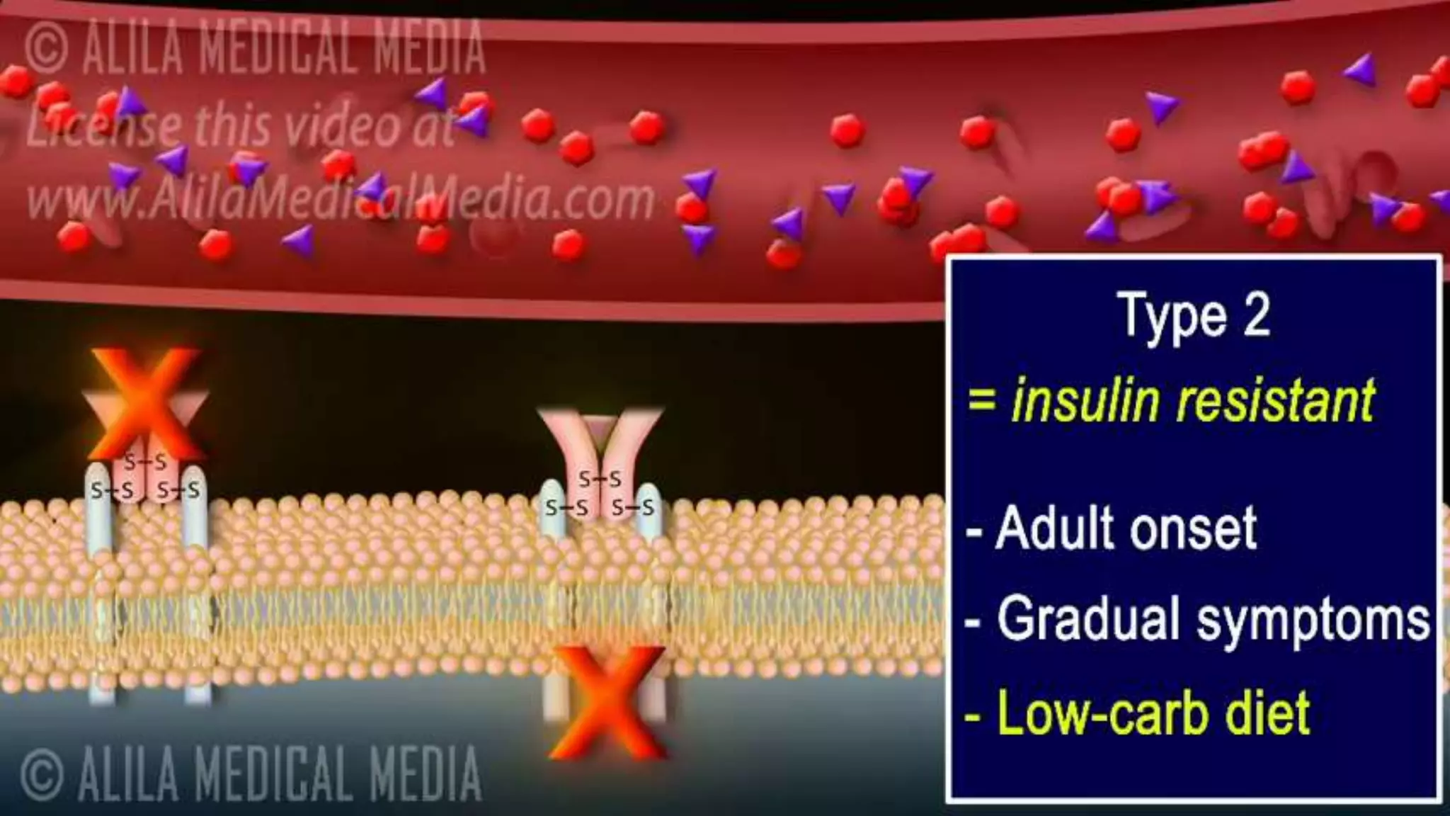 Diabetes solution | PPT